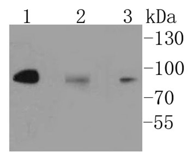 IKK alpha + IKK beta Rabbit Monoclonal Antibody 50μl - 炼石商城