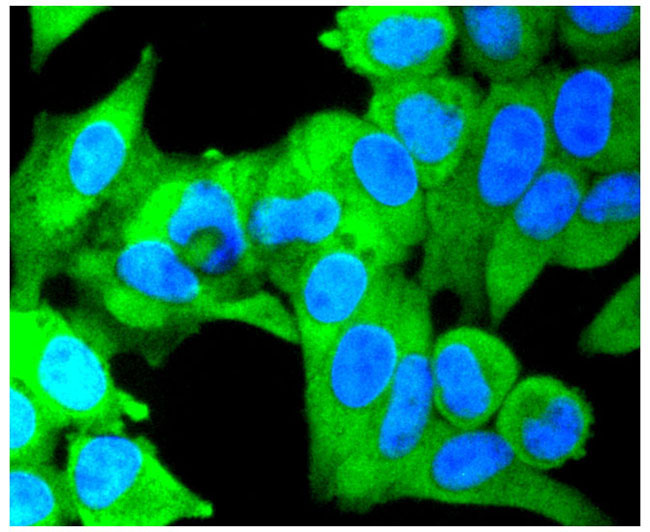 IKK alpha + IKK beta Rabbit Monoclonal Antibody 50μl - 炼石商城