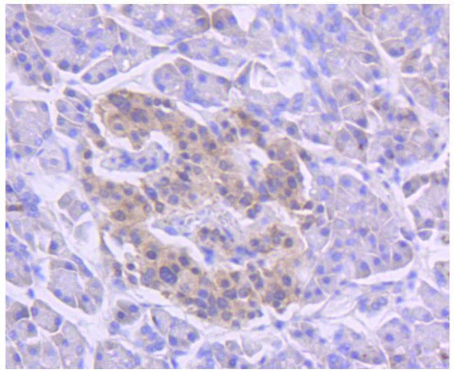 Musashi 1 Rabbit Monoclonal Antibody 50μl - 炼石商城