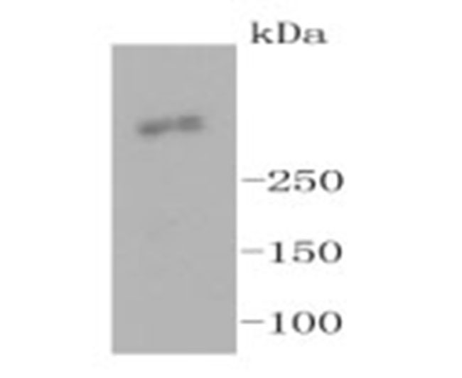 Ki67 Rabbit Monoclonal Antibody 50μl - 炼石商城