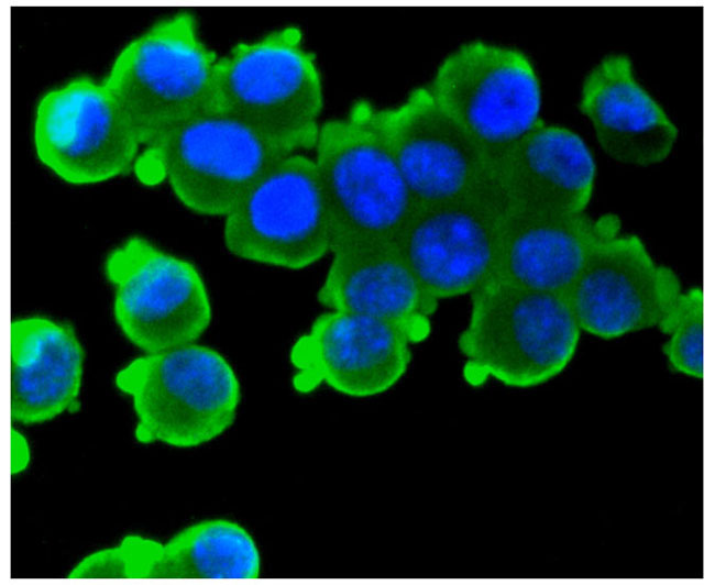 S100 beta Rabbit Monoclonal Antibody 50μl - 炼石商城