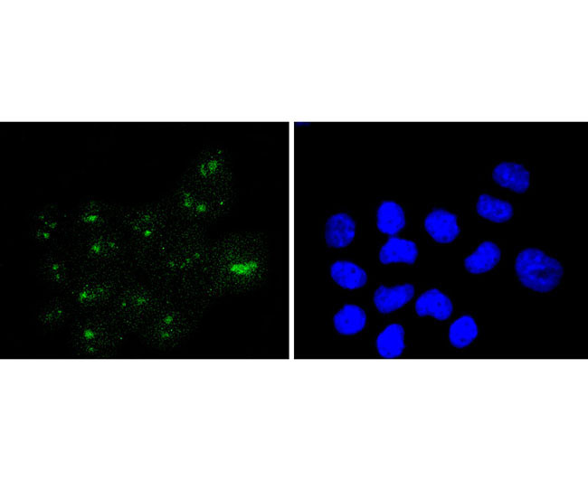 Wilms Tumor Protein Rabbit Monoclonal Antibody 50μl - 炼石商城