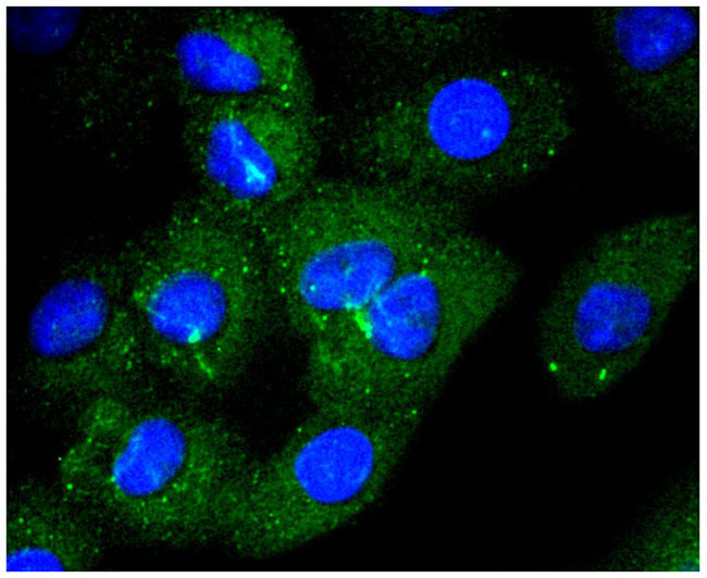 CD14 Rabbit Monoclonal Antibody 50μl - 炼石商城
