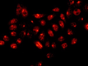 Anti-DKC1 antibody [EPR10398] 10µl - 炼石商城