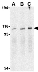 Anti-IRE1 antibody 100μg - 炼石商城