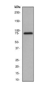 Anti-Dab1 antibody [EP2248Y] 10µl - 炼石商城