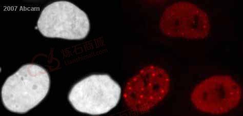 Anti-RPA32/RPA2 antibody [9H8] 500μl - 炼石商城